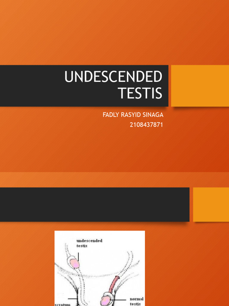 Undescended Testis | PDF