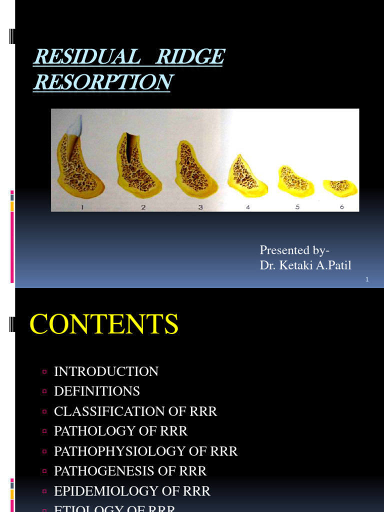 Residual Ridge Resorption | PDF | Bone | Dentures