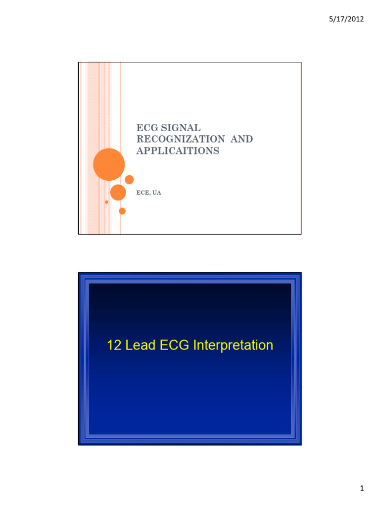 12 Lead ECG Interpretation - University of Alabama | PDF