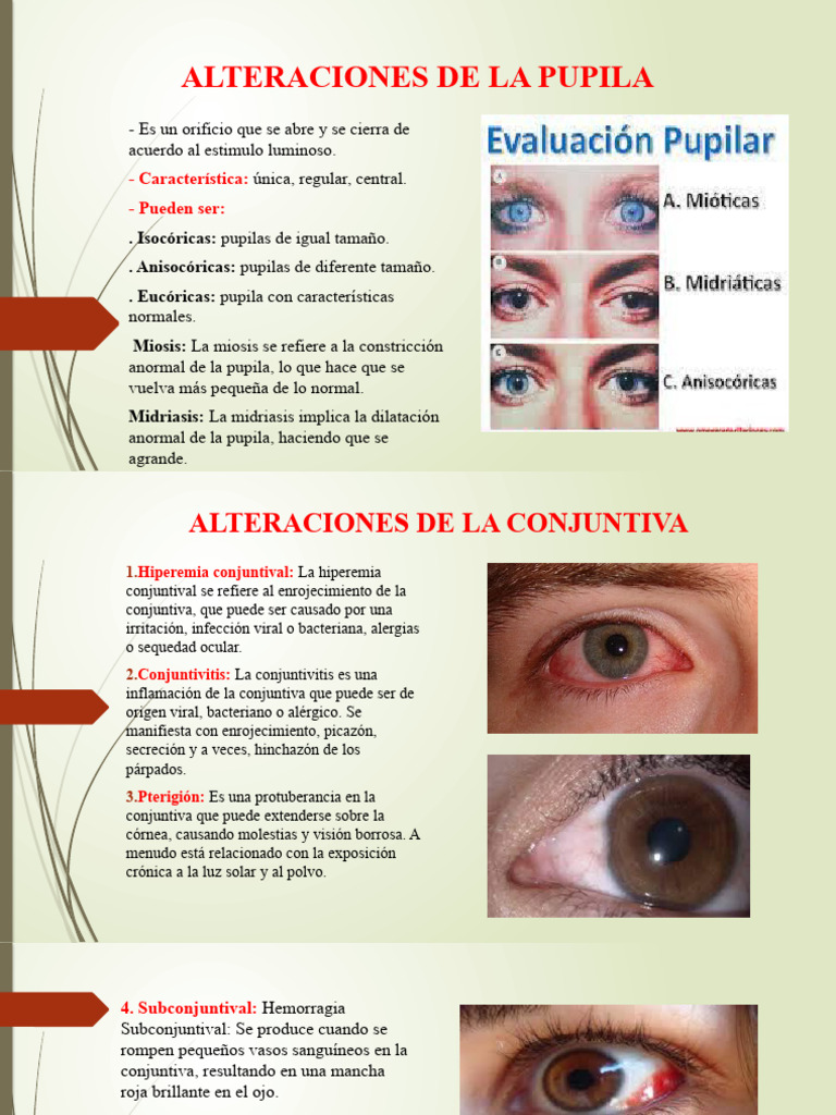 Alteraciones de La Pupila, Yanzi | PDF | Alergia | Epidemiología