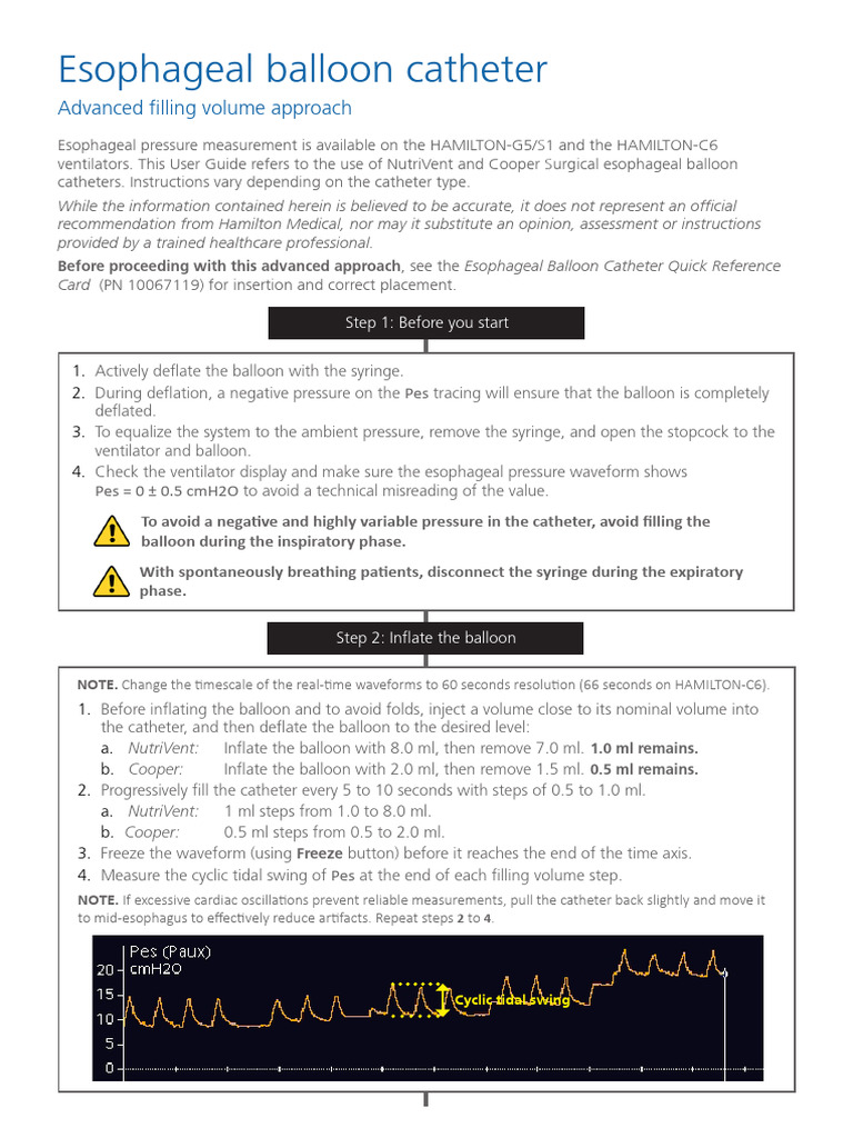 Esophageal Balloon Catheter Advanced Procedure Reference Card en ...