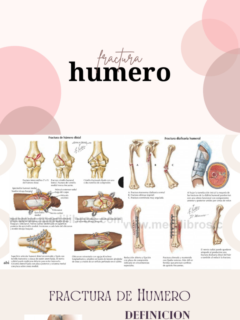 Frac Tura | PDF | Hombro | Hueso