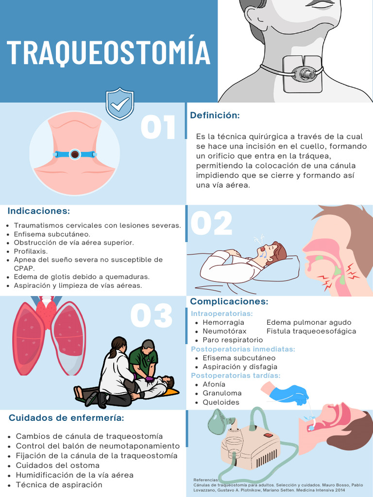 Cartel de Traqueostomía | PDF