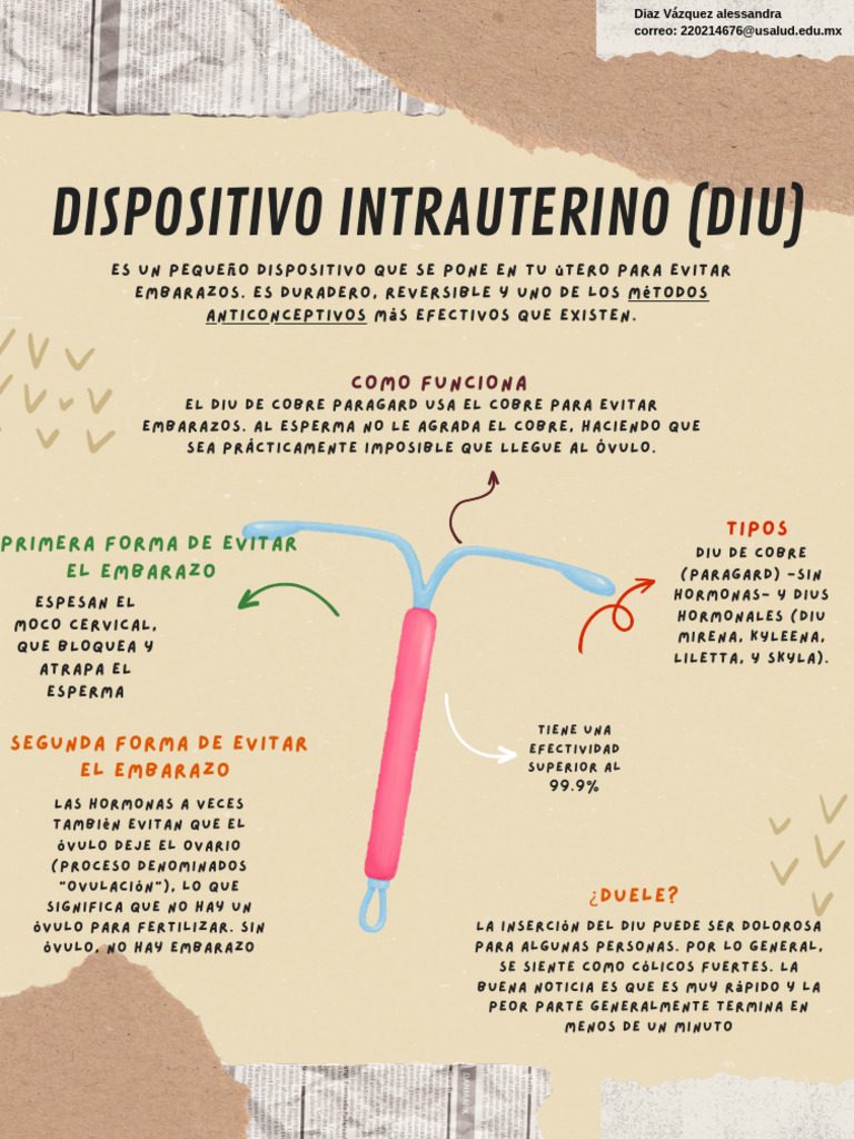 Dispositivo Intrauterino (Diu) : Como Funciona | PDF
