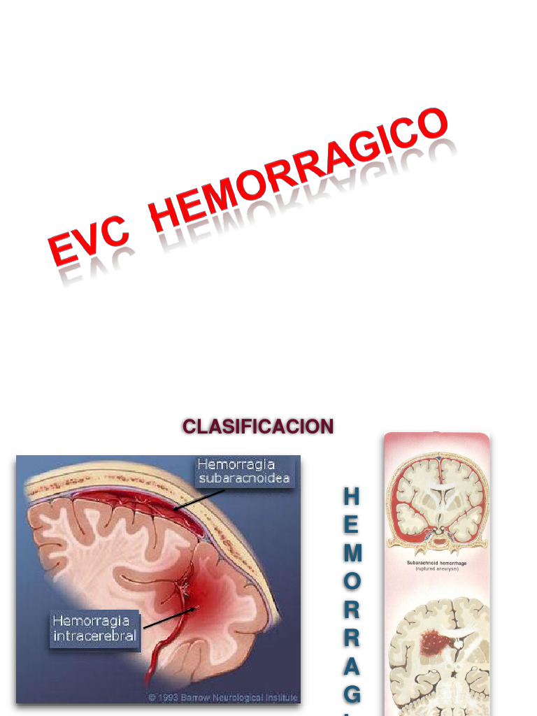 EVC Hemorragico | PDF | Medicina CLINICA | Especialidades Medicas