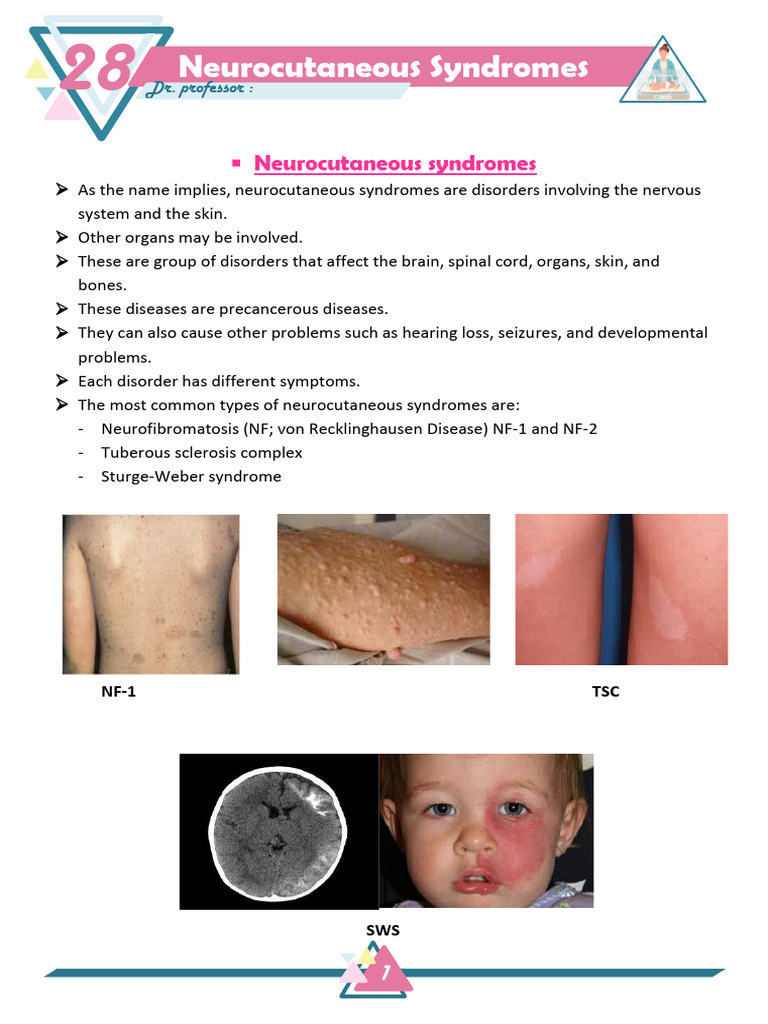 Neurocutaneous Syndromes Overview | PDF | Cerebral Palsy | Epilepsy