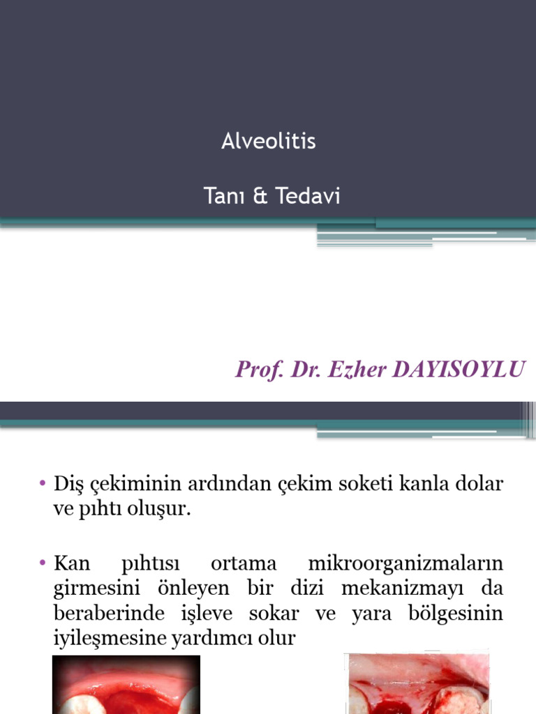 Alveolit Ders | PDF
