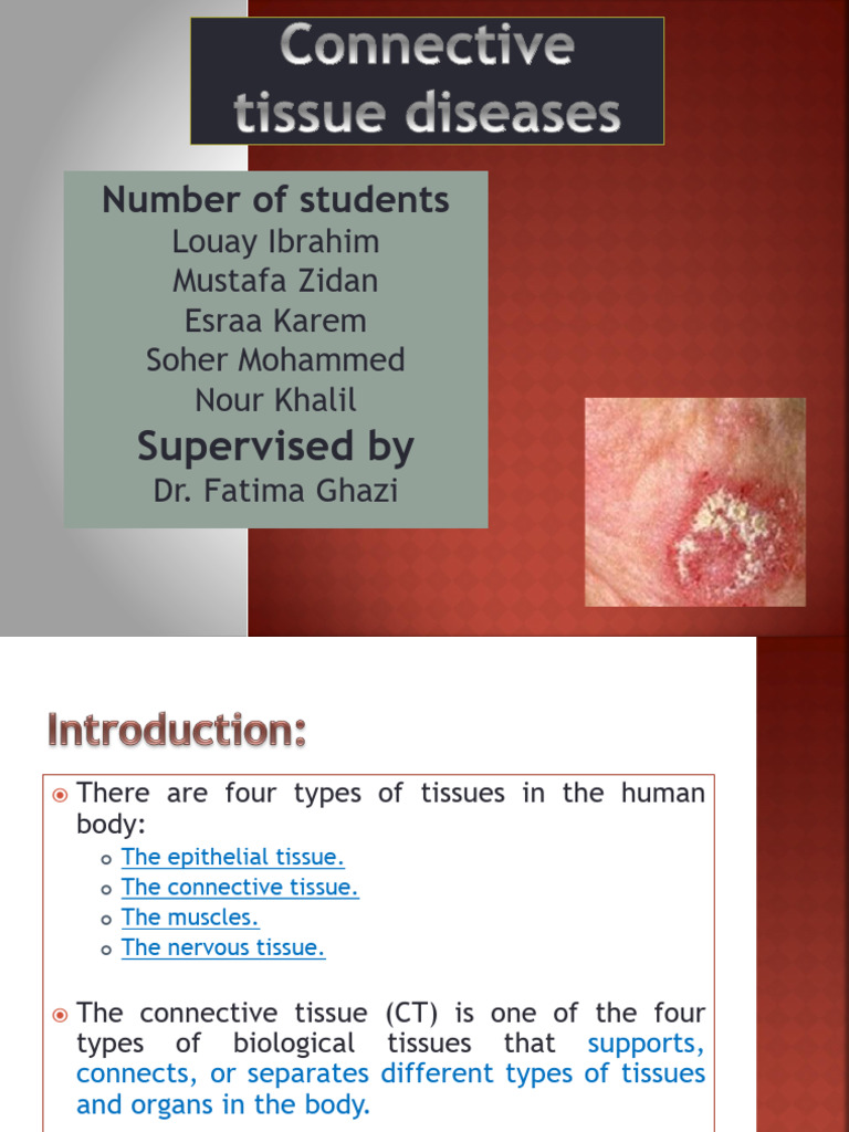 Human Connective Tissue Disorders | PDF | Clinical Medicine | Medical ...