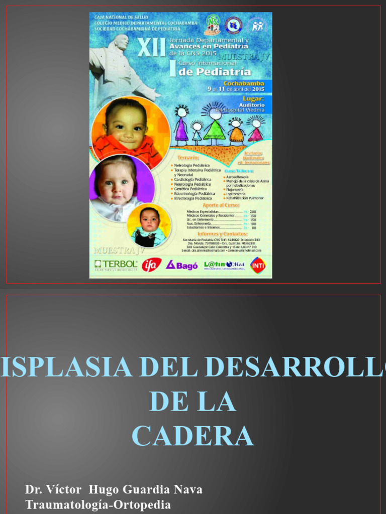 Presentasion Displasia CNS | PDF