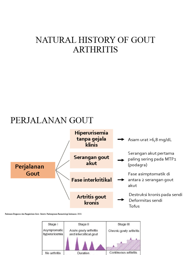 Natural History of Gout | PDF
