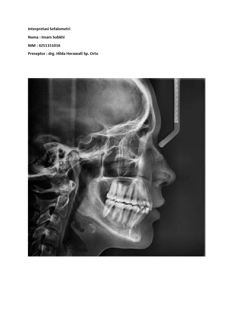 Interpretasi Sefalometri | PDF