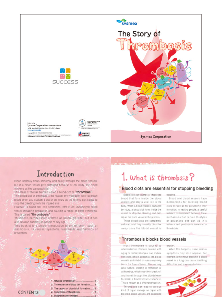 The Story of Thrombosis | PDF | Thrombosis | Thrombus