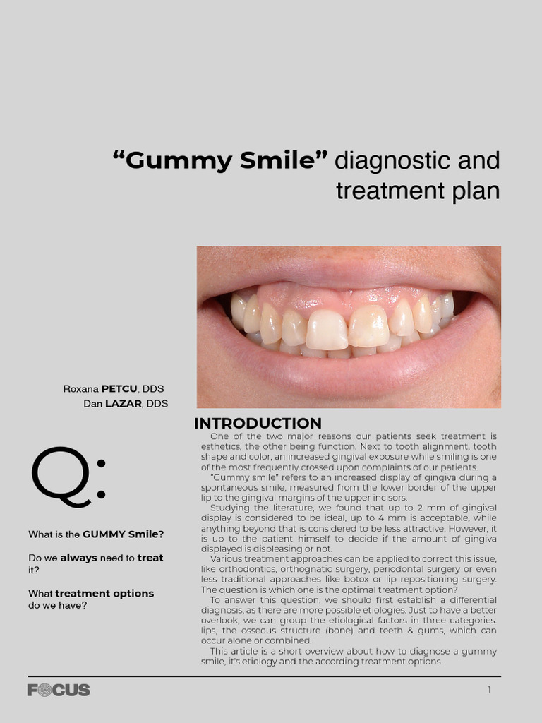 Gummy Smile - Diag and Treatment Plan | PDF | Periodontology ...