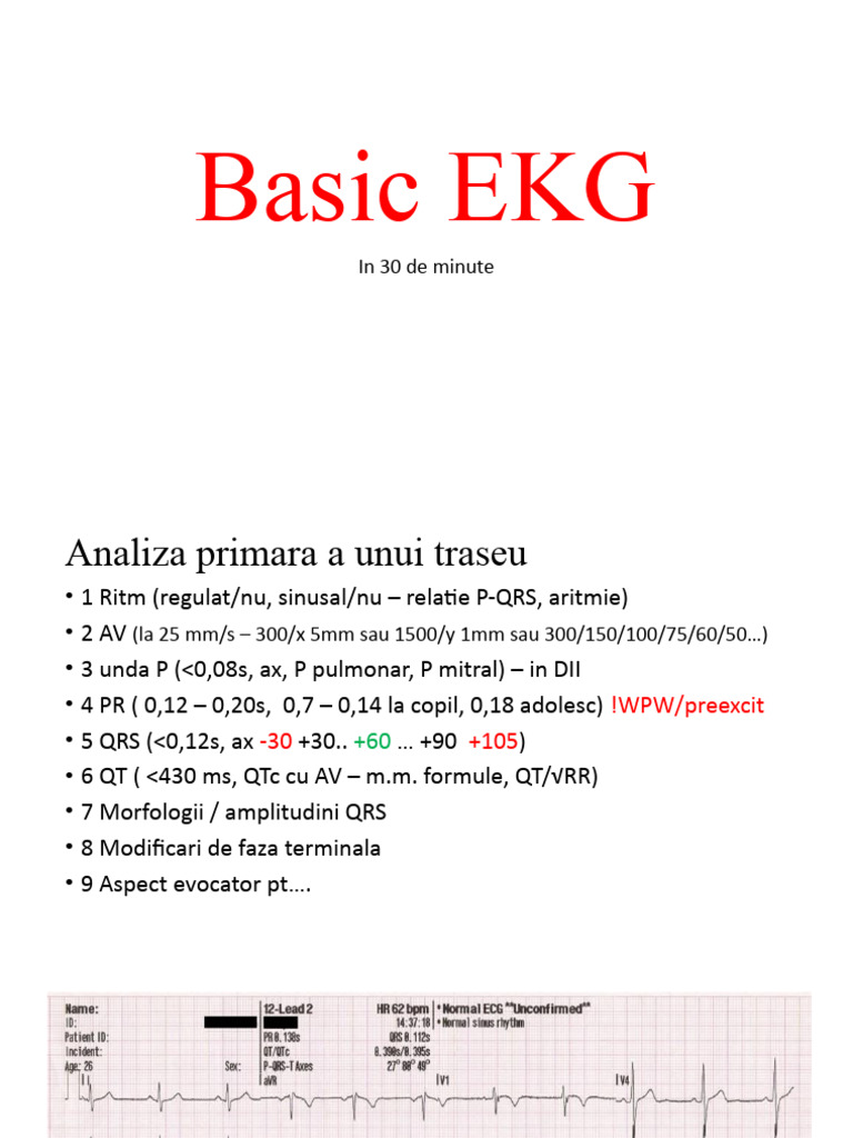 Basic EKG | PDF