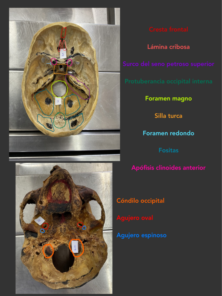 Atlas Neurocraneo | PDF