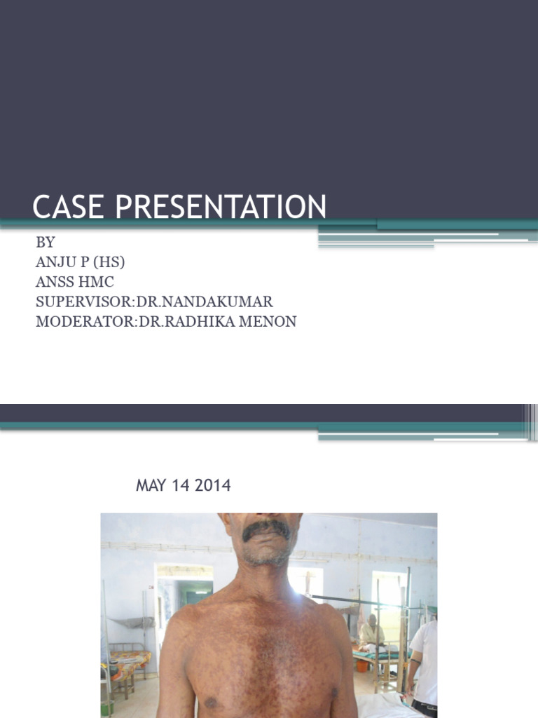 Anju P | PDF