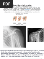 Modified Kocker's Method for Shoulder Dislocation | PDF | Shoulder ...