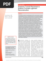 ACUFEX Anatomic ACL Reconstruction Guide | PDF | Knee | Lower Limb Anatomy