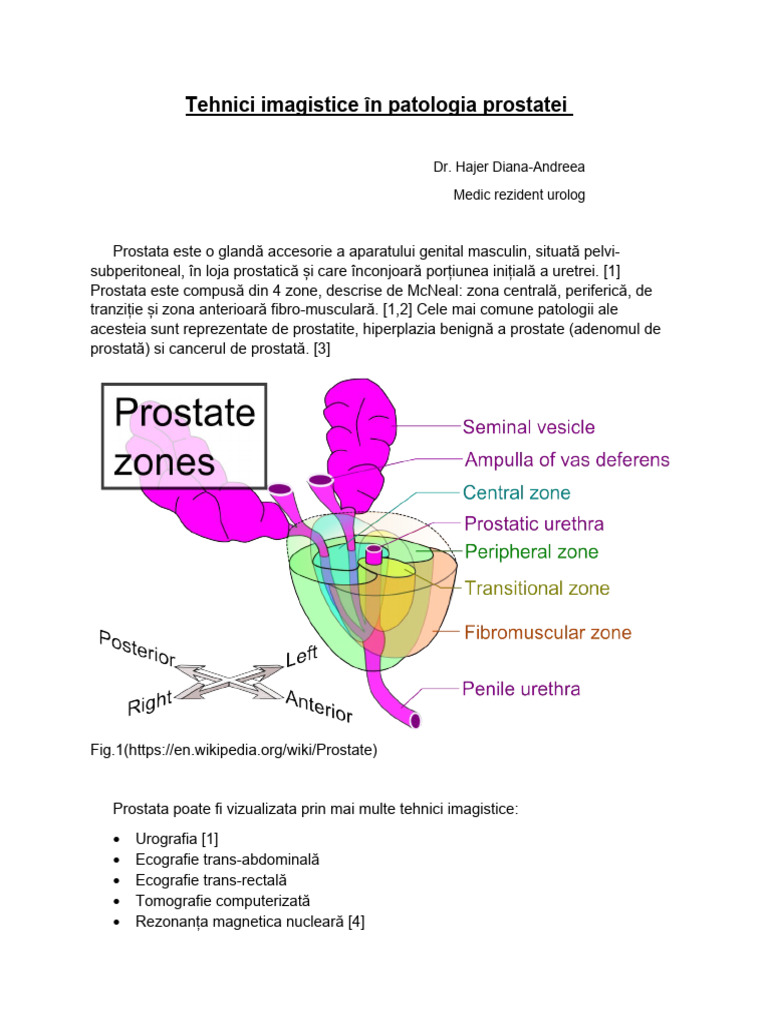 Tehnici Imagistice in Patologia Prostatei | PDF