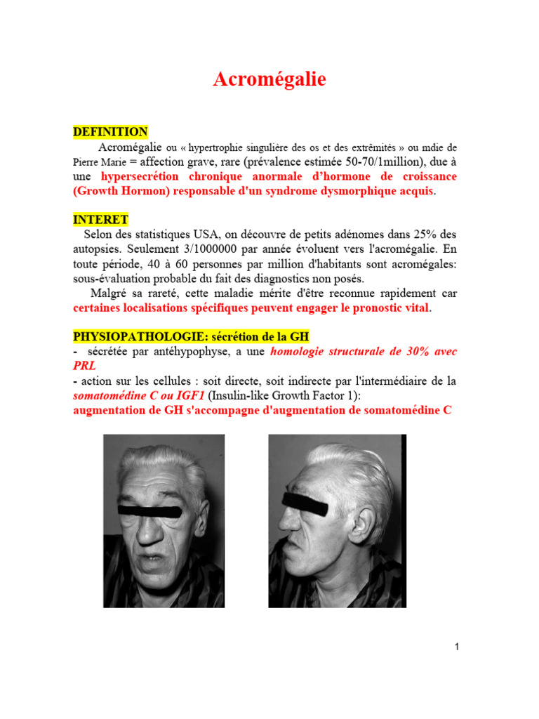 Acromégalie : Diagnostic et Symptômes | PDF | Anatomie humaine | Organe