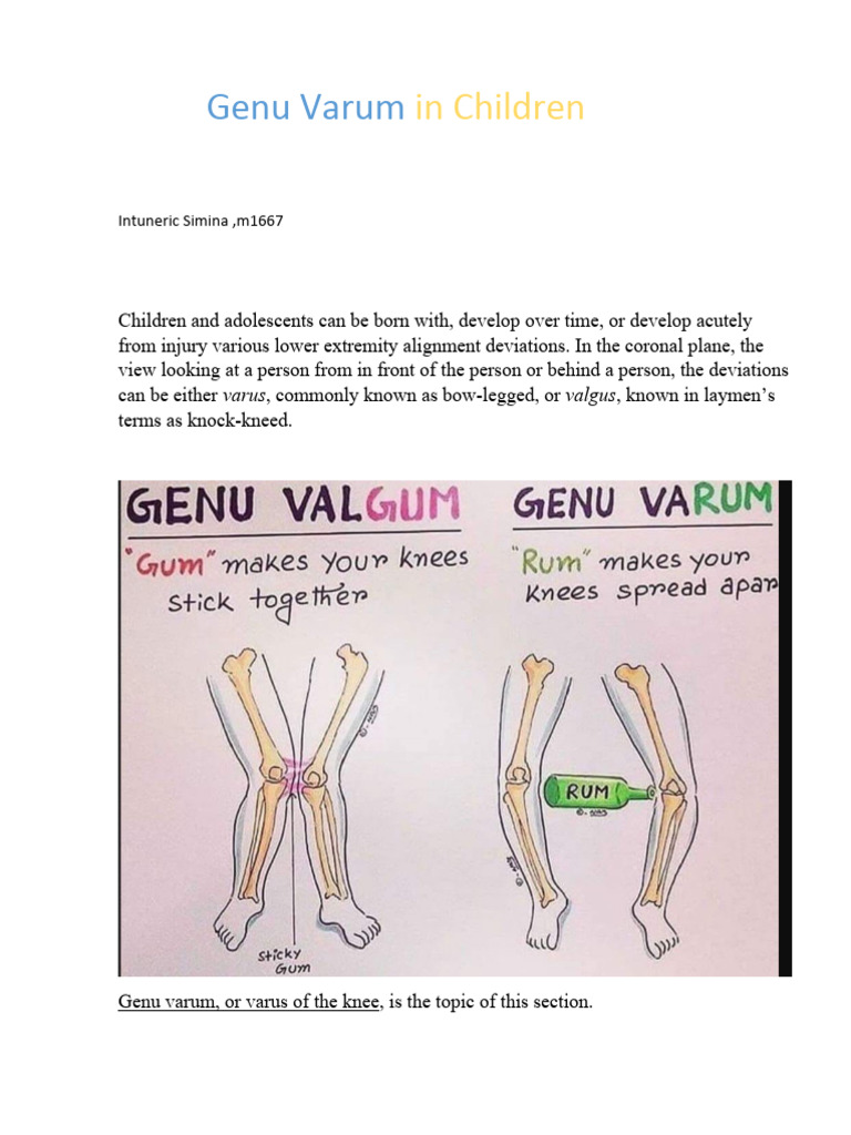 Genum Varum - BOW LEGS | PDF