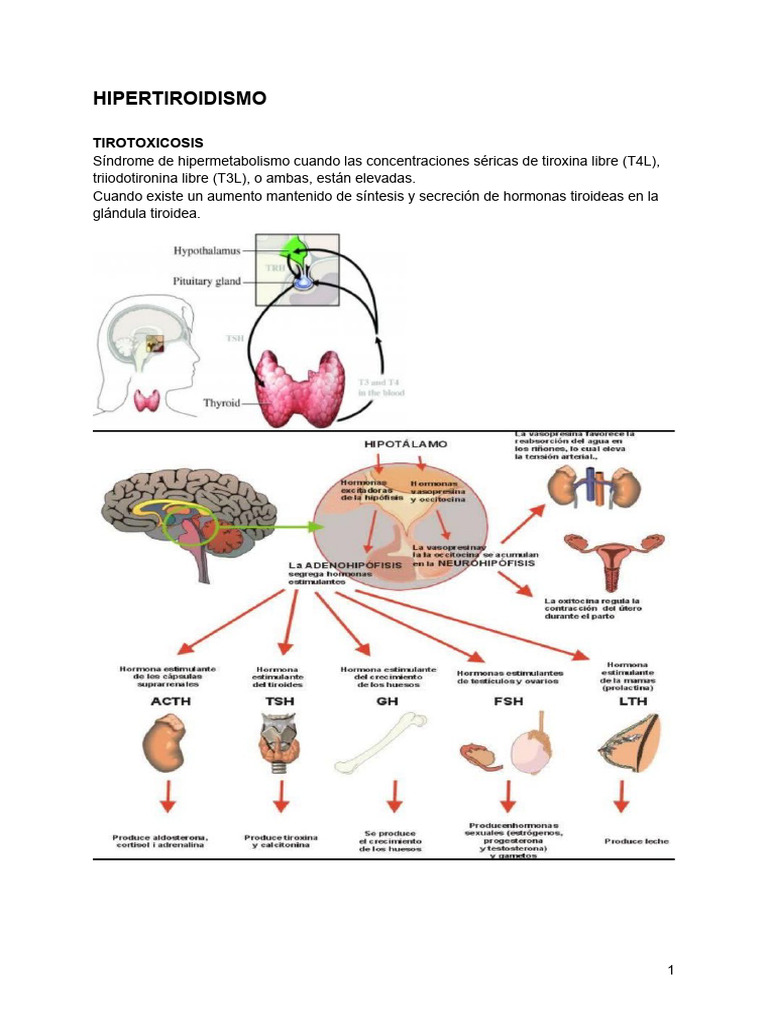 HIPERTIROIDISMO | PDF