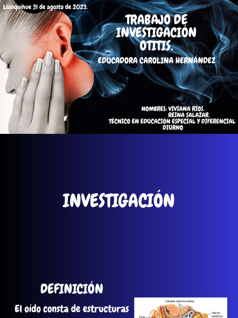 Trabajo de Investigación Otitis. | PDF | Oído | Escuchando