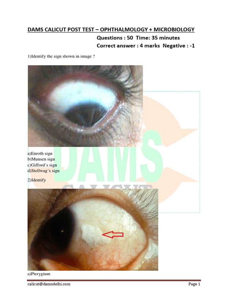 Dams Calicut Ophthal Exam | PDF | Clinical Medicine | Ophthalmology