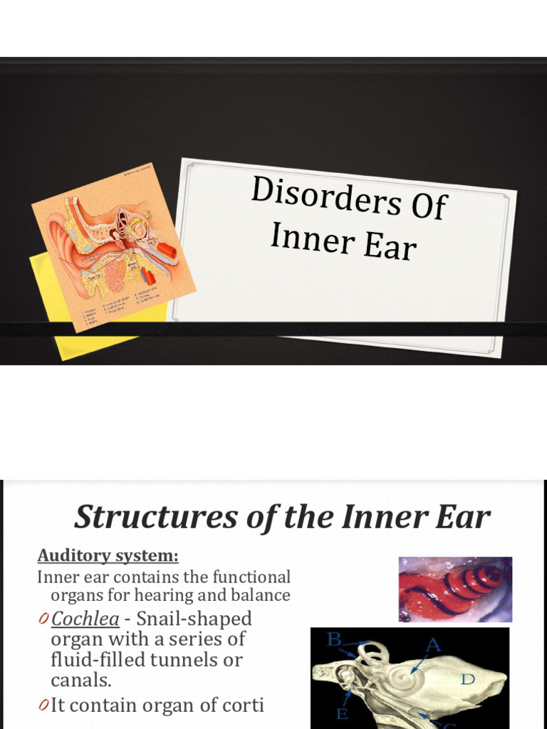 Disorders of Inner Ear | PDF | Vertigo | Ear