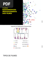 RESUMO 3 - FILMES E PROCESSAMENTO RADIOGRÁFICO | PDF | Radiografia | Raio X