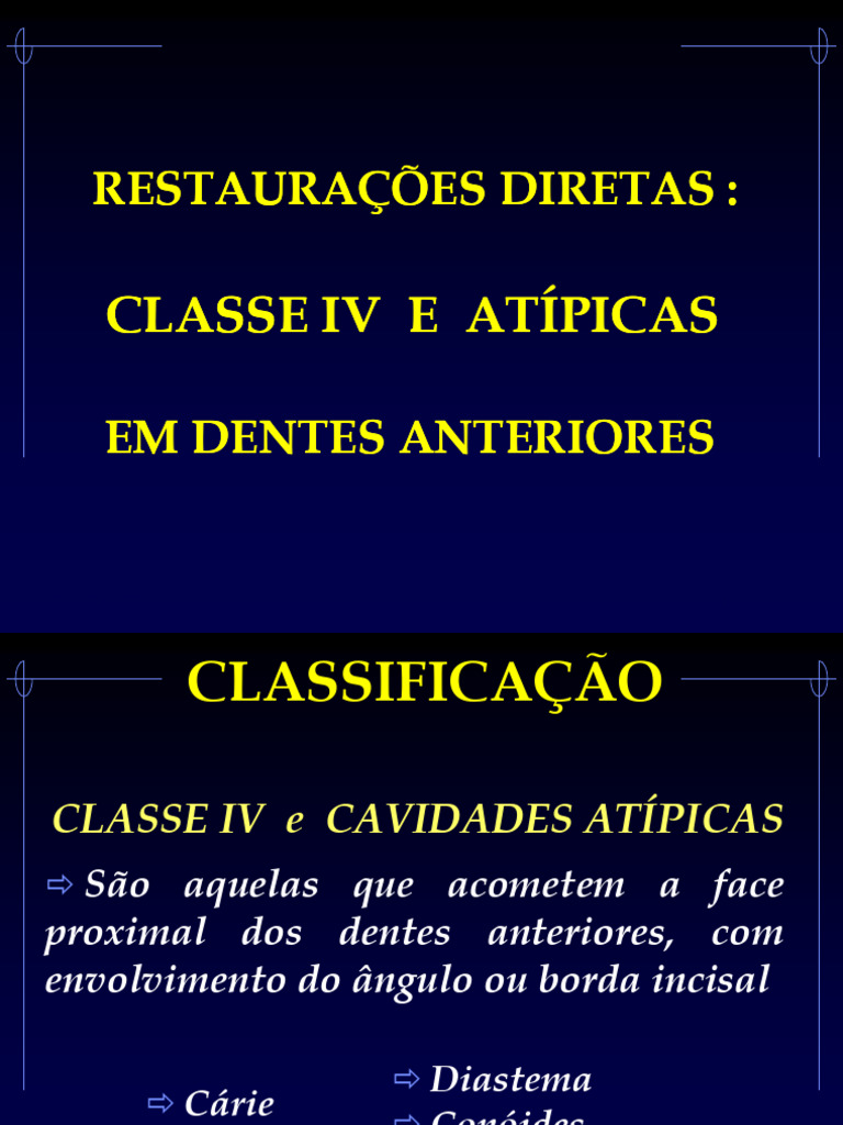 Restauração Classe IV em Dentes Anteriores | PDF | Esmalte dentário ...