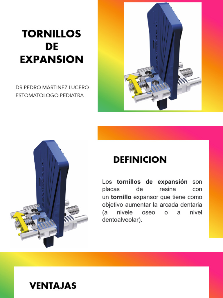 Tornillos de Expansion | PDF | Diente | Ortodoncia