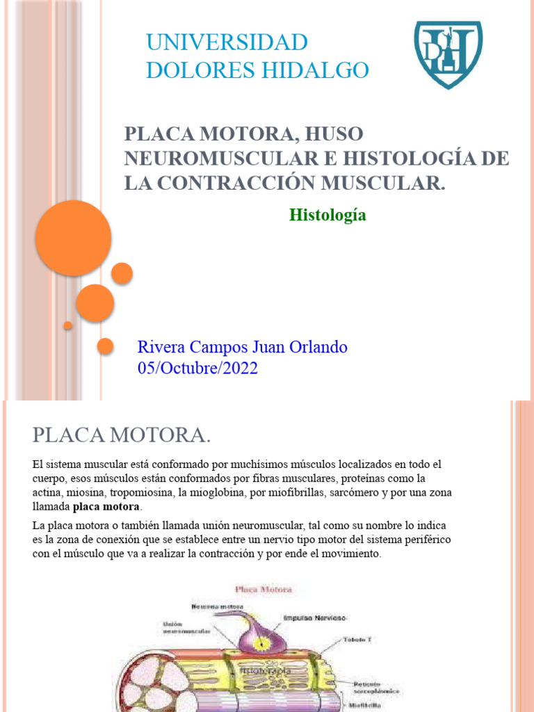 Presentación Placa Motora | PDF