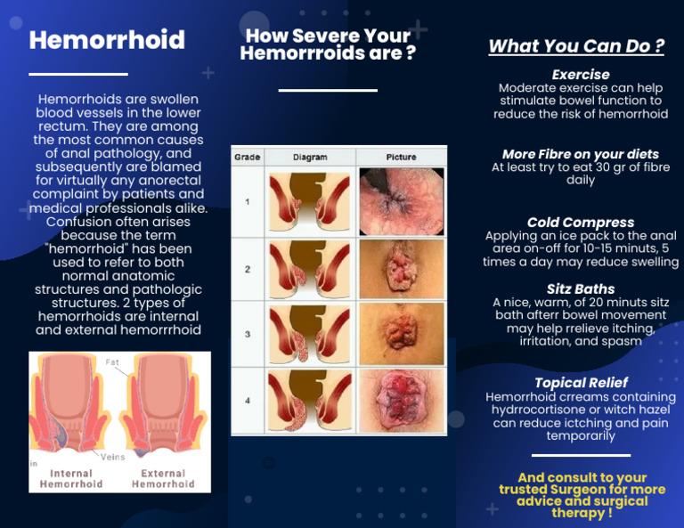 Hemorrhoids Leaflet | PDF