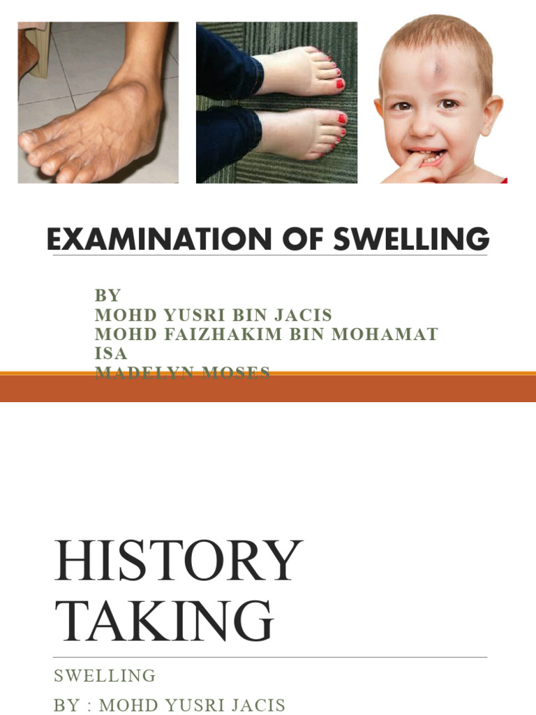 Swelling Examination Guide | PDF | Science & Mathematics
