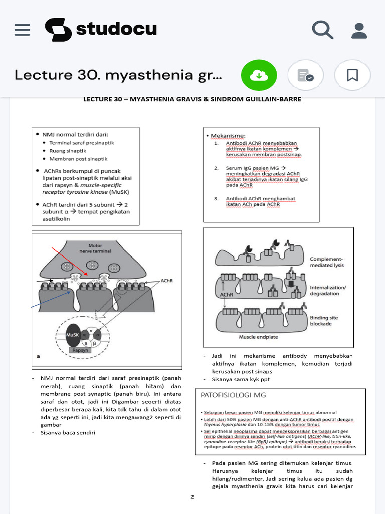 Lecture 30. myasthenia gravis & sindrom guillain-barré - MYASTHENIA ... Lecture 30. myasthenia gravis & sindrom guillain-barré - MYASTHENIA ...