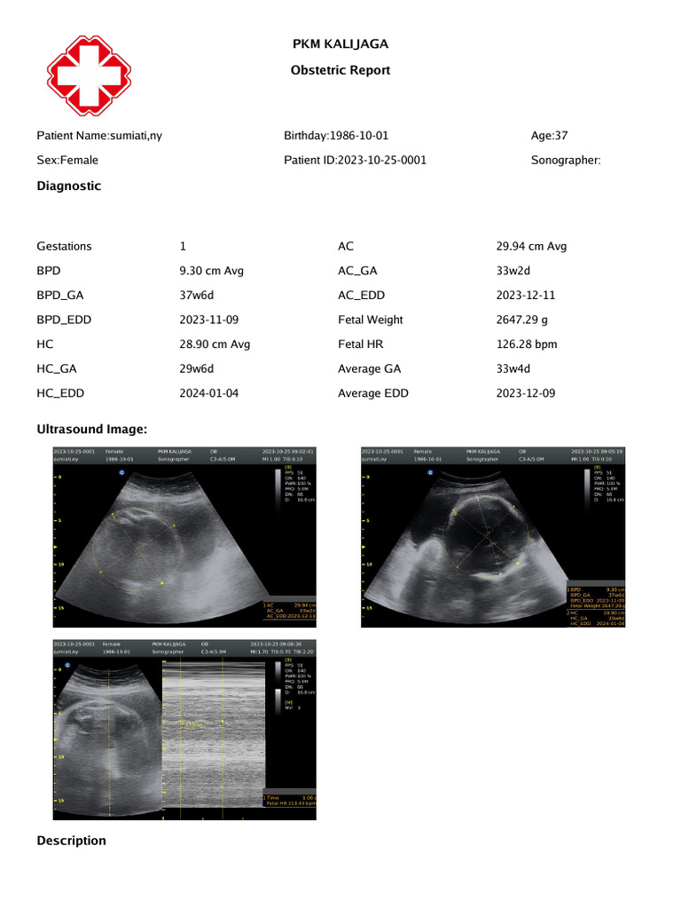 Usreport202310250001 Obstetric Report | PDF