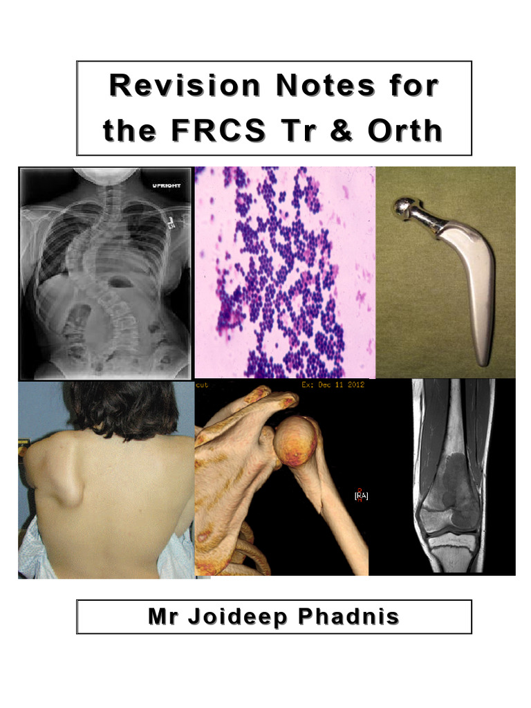 AAA Revision Notes For The FRCS TR Ortho Joideep Phadnis | PDF