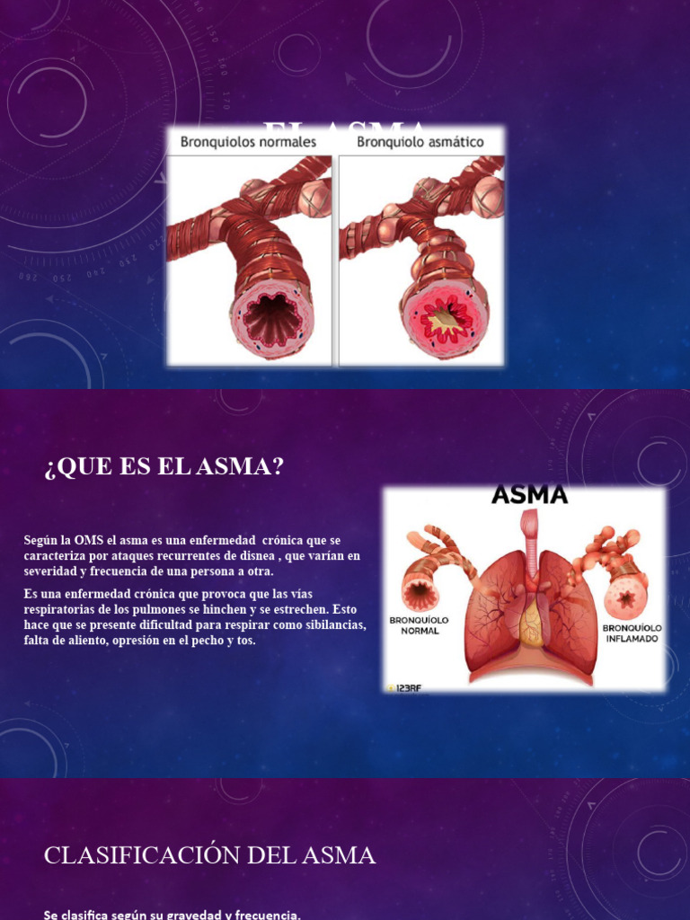 El Asma | PDF | Asma | Ciencias de la Salud