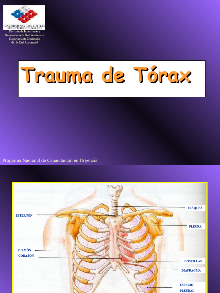 Trauma de Tórax (MINSAL) | PDF | Lesión | Tórax