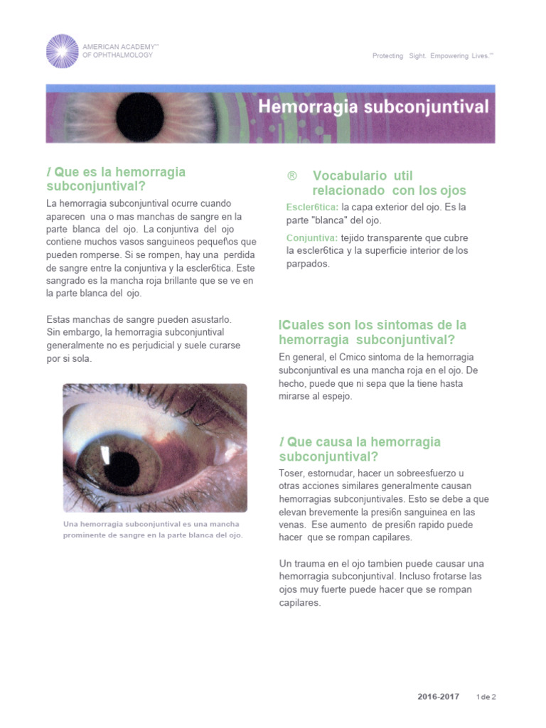 Hemorragia Subconjuntival | PDF | Sangrado | Sangre