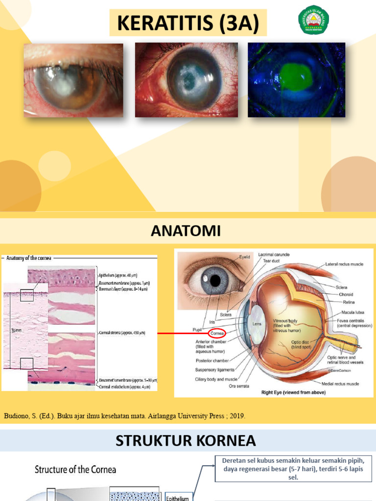 Klasifikasi dan Penanganan Keratitis | PDF