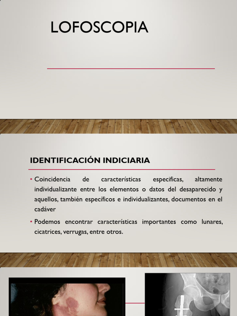 Lofoscopia Forense 1 | PDF | Huella dactilar