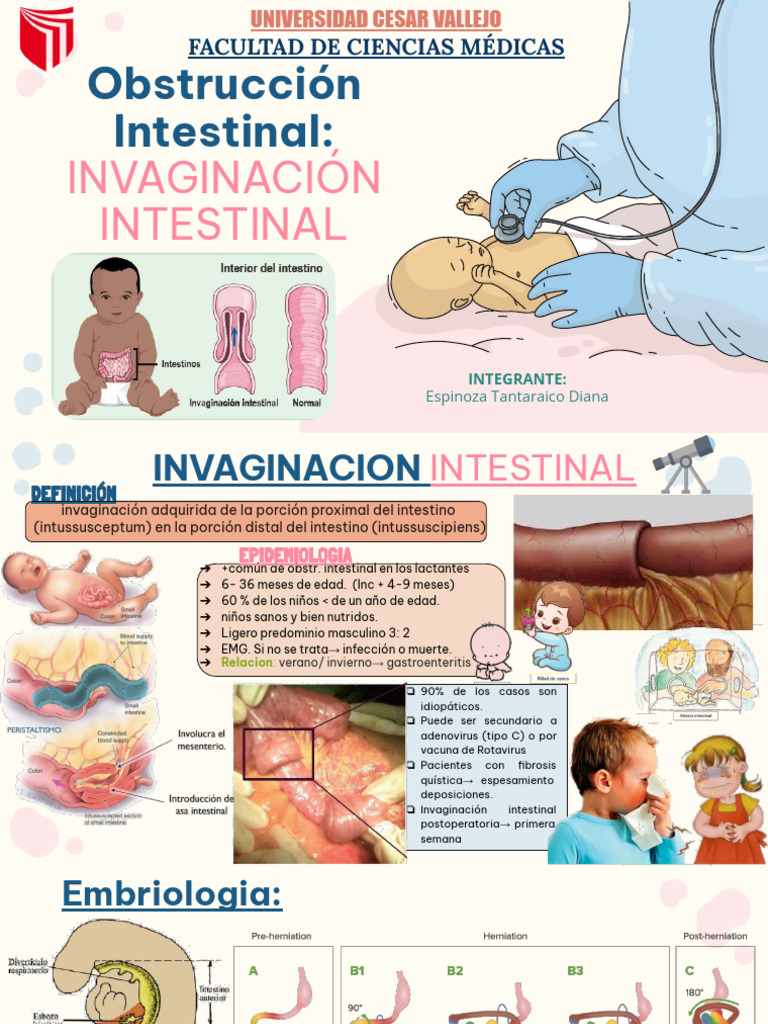 Obstruccion Intestinal | PDF | Enfermedades y trastornos humanos | Medicina