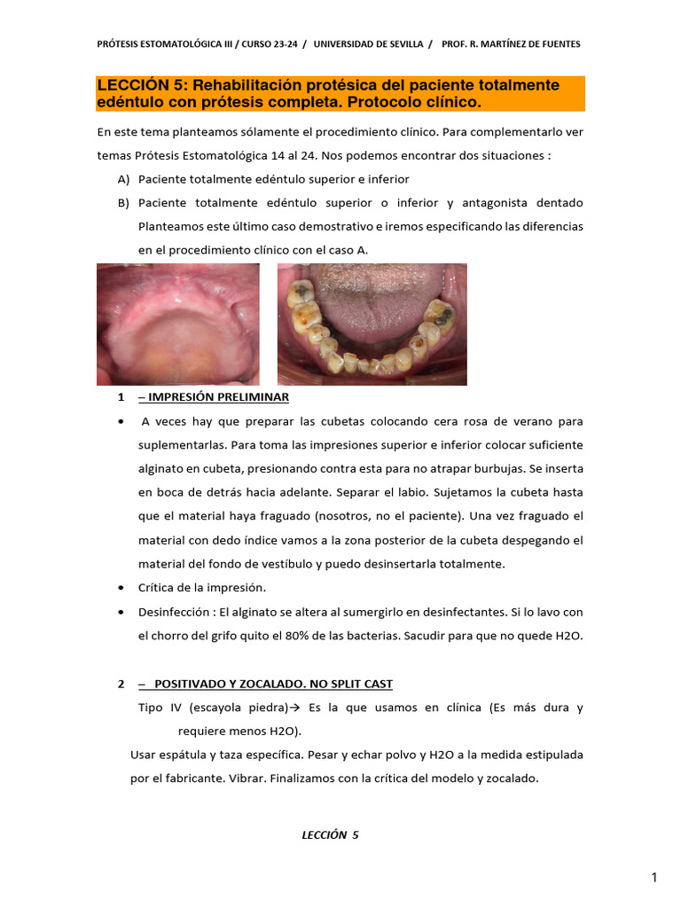 Lección 5. Rehabilitación Protésica Del Paciente Totalmente Edéntulo ...