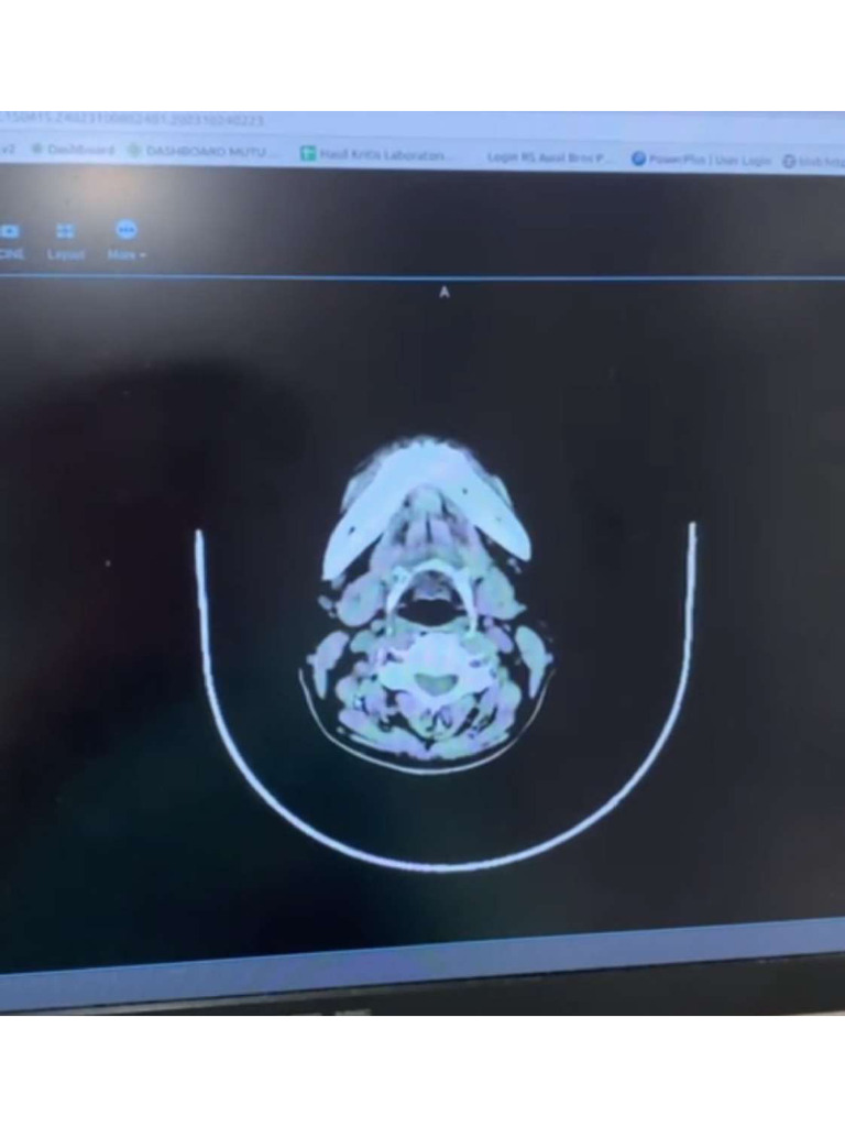 Contoh CT Scan | PDF