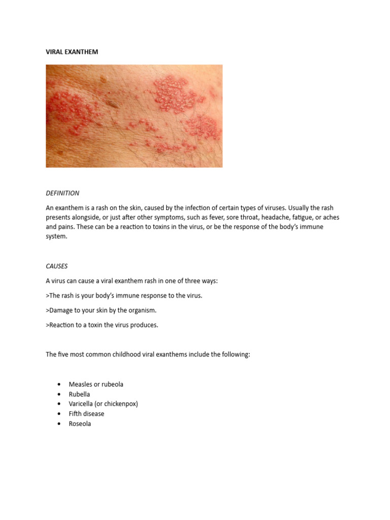 Viral Exanthem: Causes and Care | PDF | Wellness | Science & Mathematics