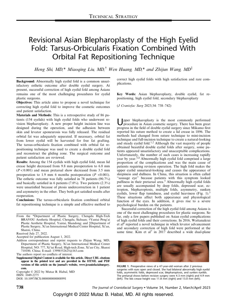 Revisional Asian Blepharoplasty of The High Eyelid Fold - Tarsus ...