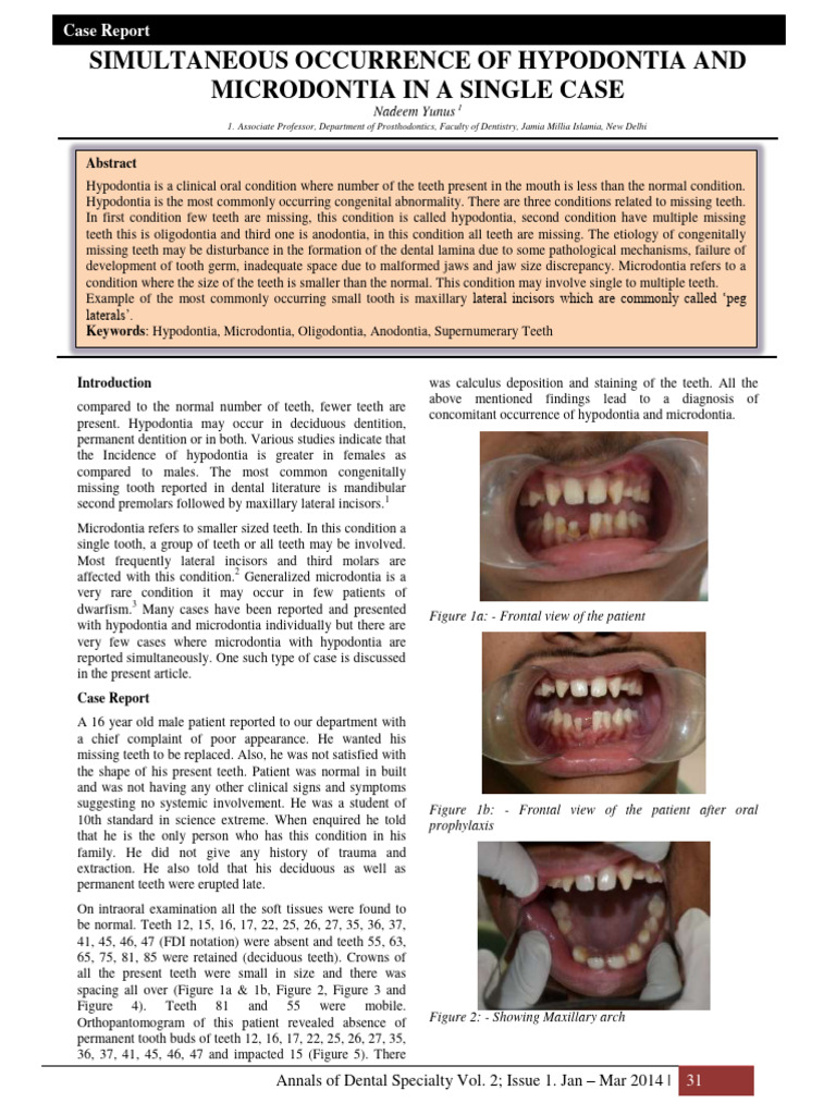 Hypodontia and Microdontia Case Study | PDF | Health Care | Dental Anatomy