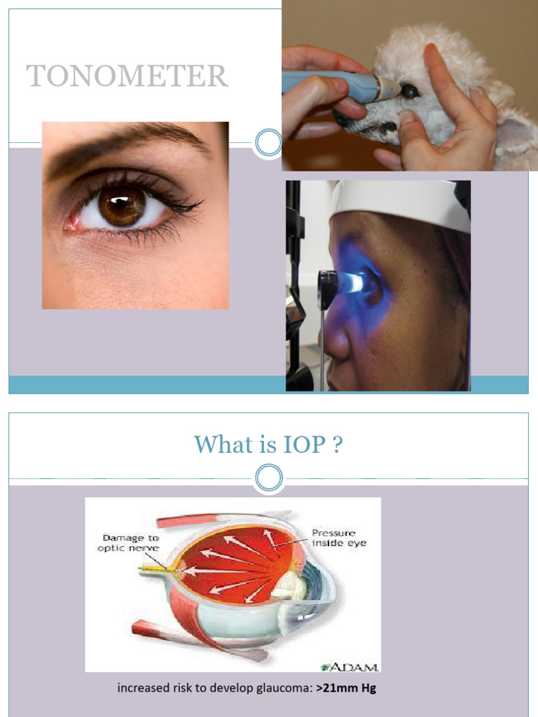 Tonometer Edited | PDF | Glaucoma | Eye